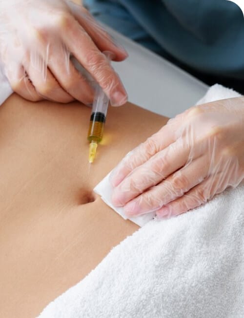 Mesotherapy in Johns Creek | Allure MedSpa